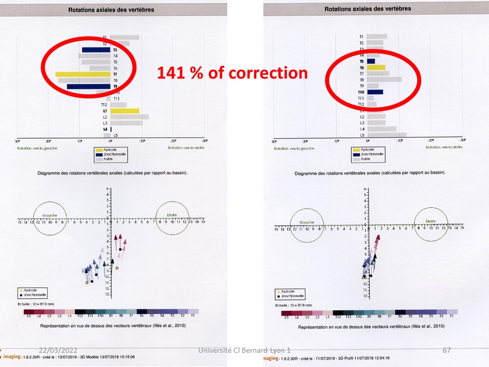 Coupled movements - Méthode lyonnaise